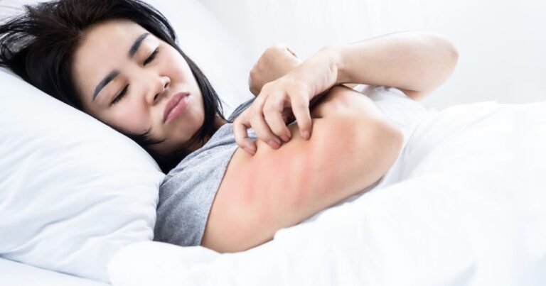 How Do Bed Bugs Spread from Person to Person?